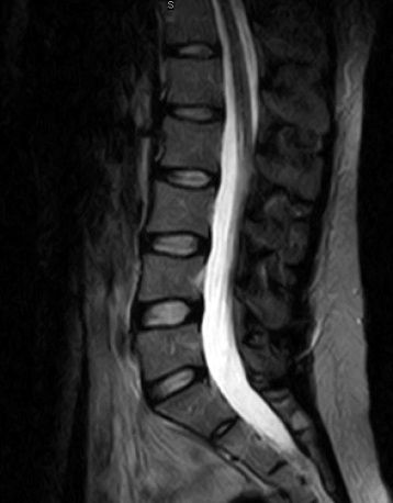 Gerinc MR - Budai Egészségközpont