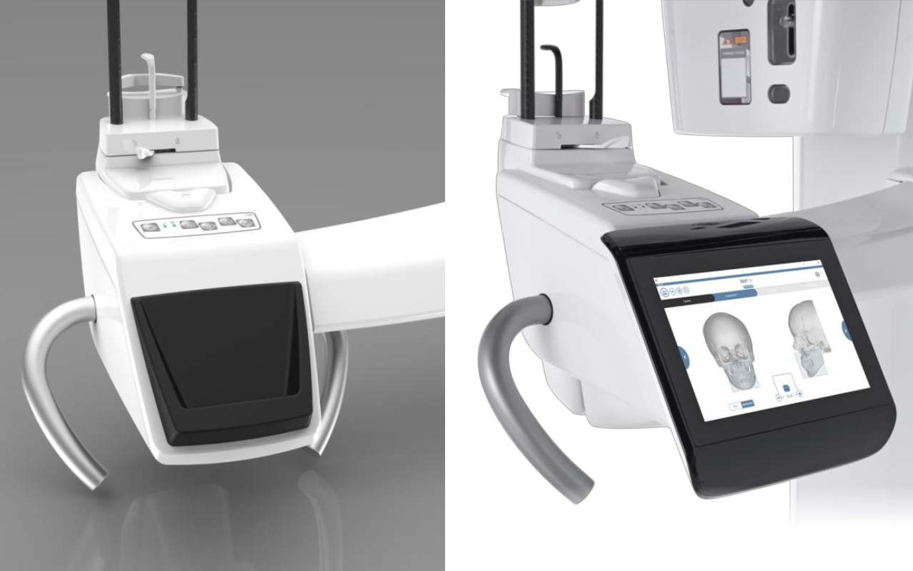 CBCT vizsgálat - Budai Egészsgközpont